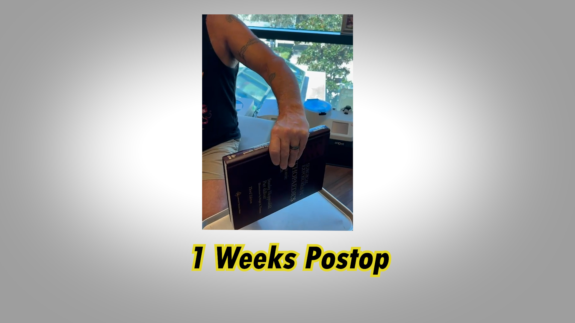 ZipTek Global - Surgical Repair Technology | Resorbable Locking Systems