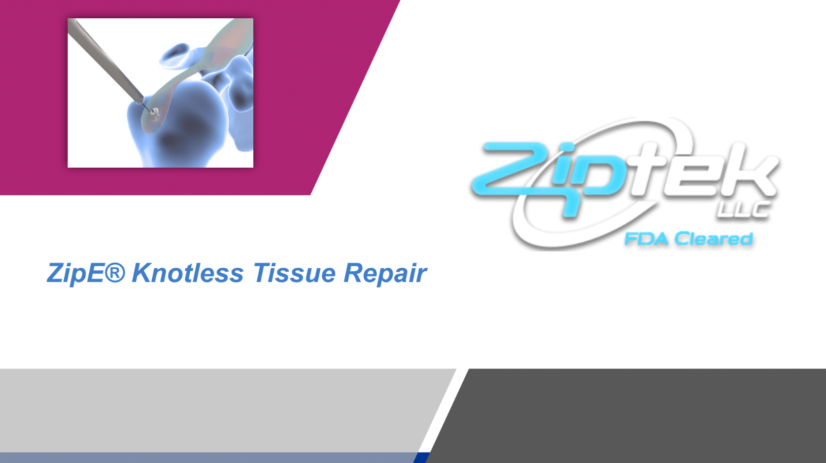 ZipTek Global - Surgical Repair Technology | Resorbable Locking Systems